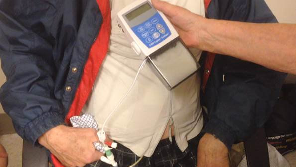 DUODOPA® (Levodopa/Carbidopa Intestinal Gel) THERAPY